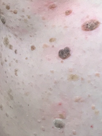 Seb Ks 1 - Dr. Kate Kelly - The Ottawa Clinic